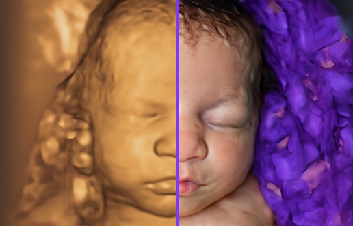 Babyview - Leading 8K Ultrasound Technology